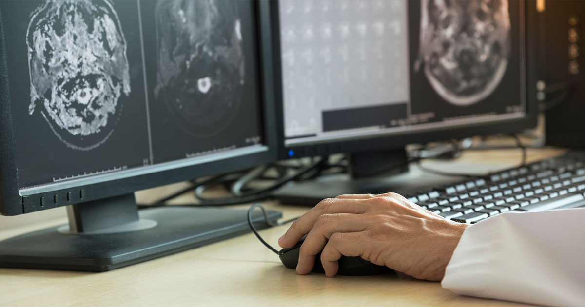 How Accurate is Prostate MRI? A Survey of the Literature - Sperling ...