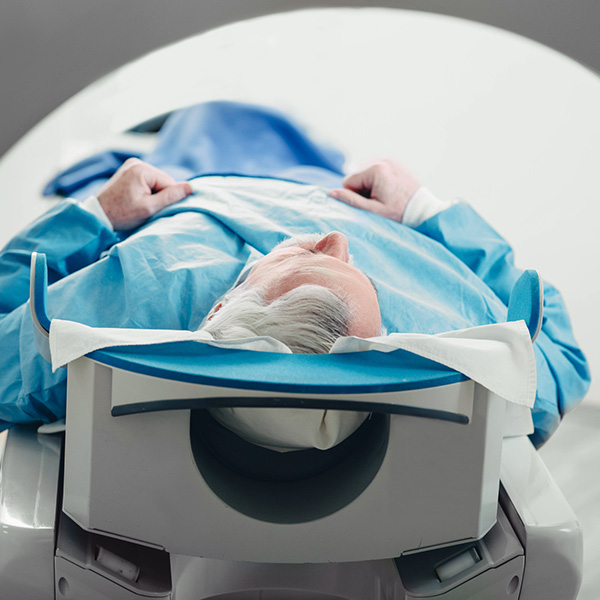 Prostate Cancer Metastasis Archives - Sperling Prostate Center