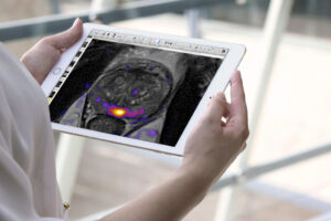 Understanding the PI-RADS Score and What it Means for You - Sperling ...