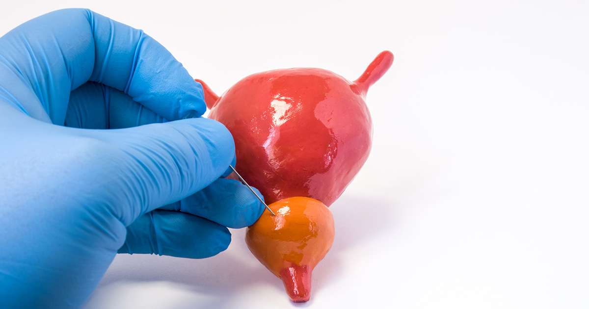 Are You Scheduled for a TURP? Stop! Consider an In-Bore Biopsy First ...